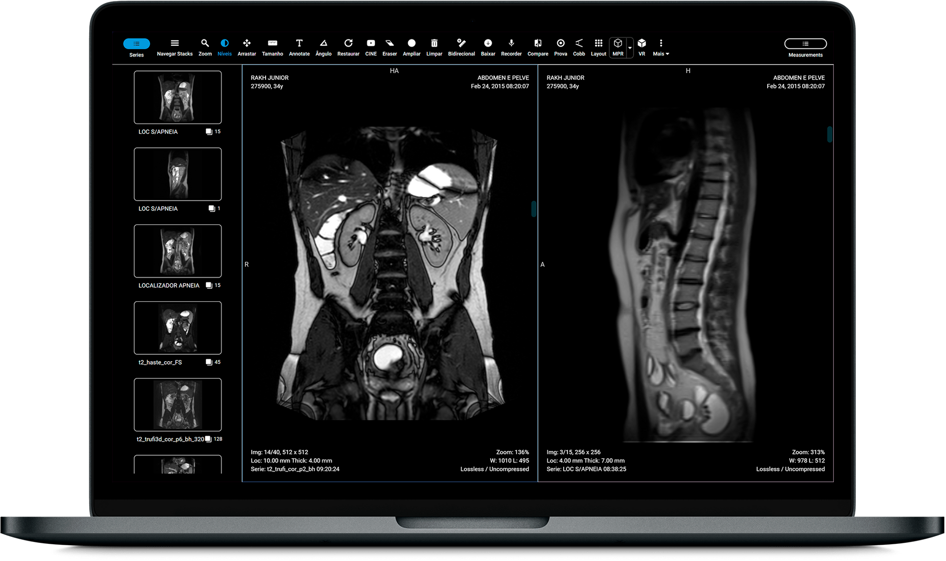Medcloud – PACS, RIS, Patient Portal and Storage
